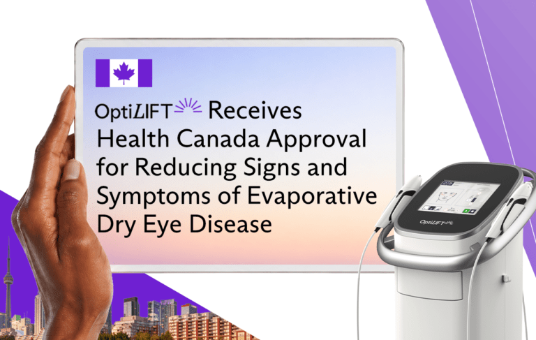 How OptiLIFT Transforms Lower Lid Laxity Treatment | Lumenis